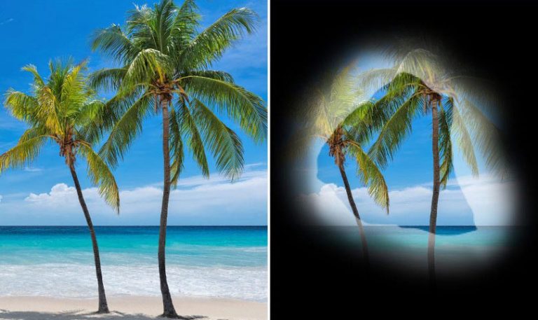 Comparison Between Glaucoma And Normal Eye – Glaucoma.Care